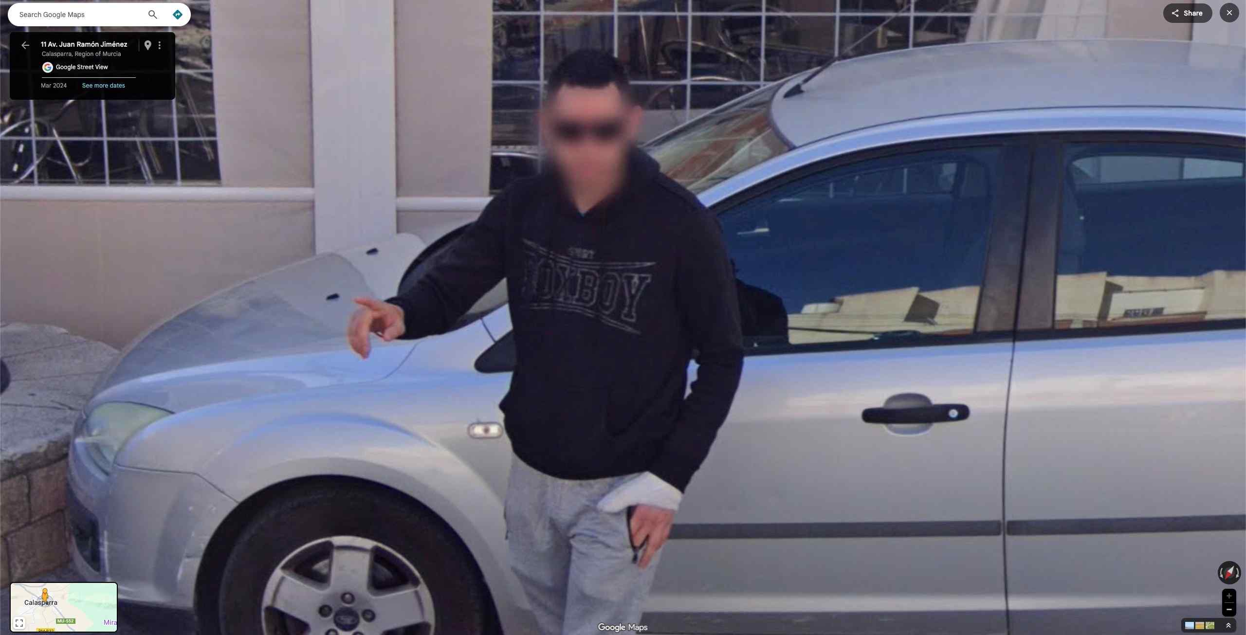 What happened to your thumb? - STREETVIEWFUN